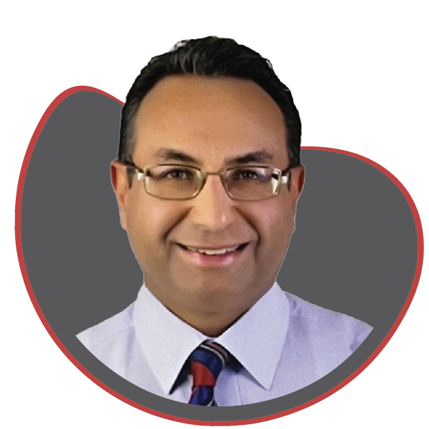 3rdCJM - 3rd Complex Joint