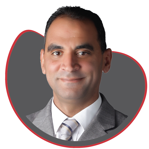 3rdCJM - 3rd Complex Joint