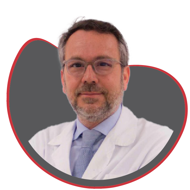 3rdCJM - 3rd Complex Joint